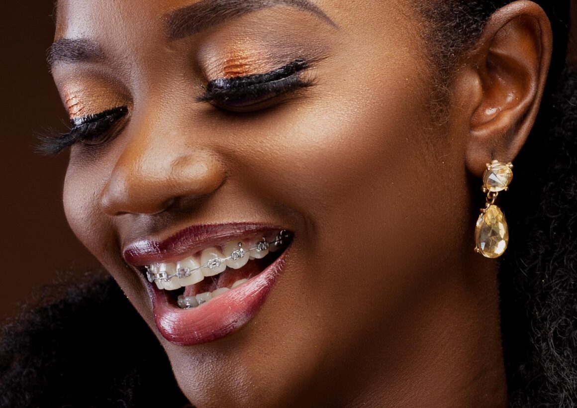 Benefits of braces - Nairobi Sterling Dental Clinic | 0762 223 925